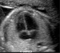 Mastering The 4-Chamber View – myminifellowship